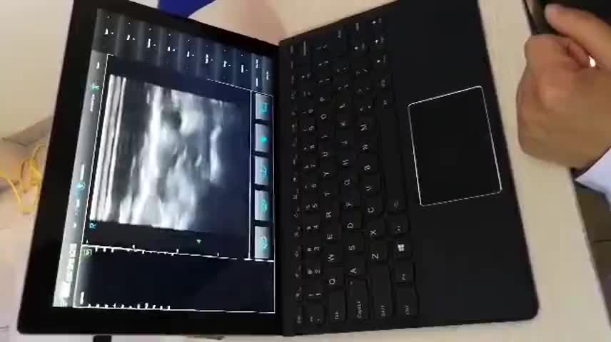 Color Doppler Cheaper Than Ultrasound Toshiba Buy Ultrasound Toshiba color-doppler-cheaper-than-ultrasound-toshiba-buy-ultrasound-toshiba